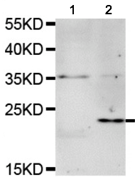 Anti-MAX (phospho S11) antibody (ab210819) | Abcam