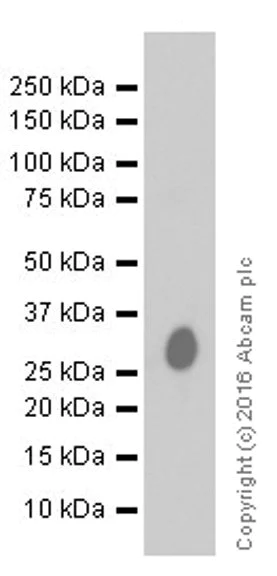Anti-MBL1+MBL2 antibody [EPR18381-156] (ab190834) | Abcam