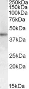 Anti-MC2-R antibody (ab77347) | Abcam