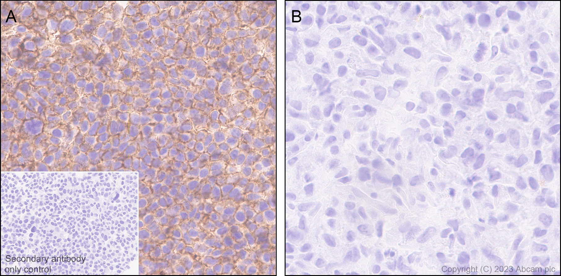 Anti-MCT1/Monocarboxylic acid transporter 1 antibody [EPR26702-83] (ab315382) | Abcam