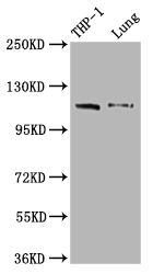 Anti-MDA5 antibody [3D12] (ab314014) | Abcam