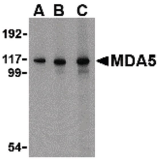 Anti-MDA5 antibody. Rabbit polyclonal (ab79055) | Abcam