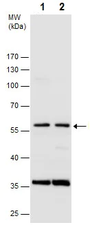 Anti-MEF2A antibody - C-terminal (ab227120) | Abcam