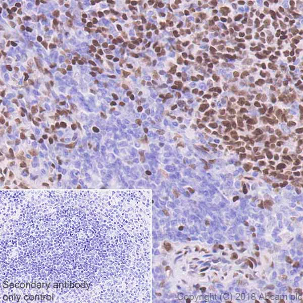 Anti-MEF2C antibody [EPR19089-202] - ChIP Grade (ab211493) | Abcam
