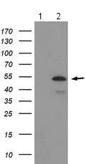 Anti-MEF2C antibody [OTI4B10] (ab118406) | Abcam