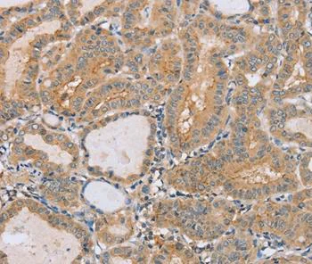 Anti-MEG1 antibody - N-terminal (ab200363) | Abcam