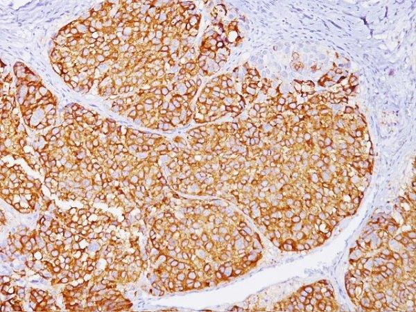 Melanoma抗体[HMB45 + M2-7C10 + M2-9E3] (ab732)| Abcam中文官网