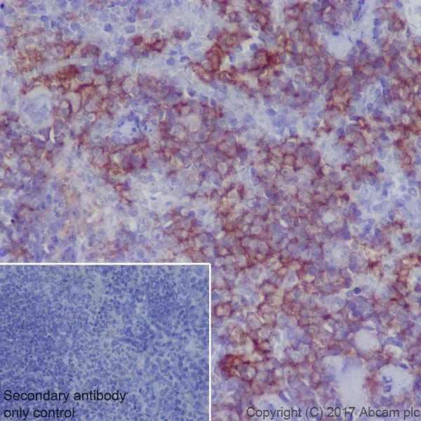 Anti-MERTK antibody [EPR17534-139] - BSA and Azide free (ab250715) | Abcam