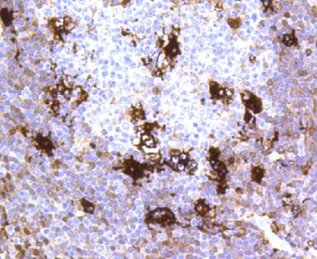 Anti-MERTK antibody [NO.H1B0] (ab238516) | Abcam