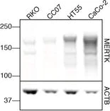 Anti-MERTK antibody [Y323] (ab52968) | Abcam