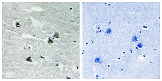 Anti-MERTK (phospho Y749) + TYRO3 (phospho Y681) antibody (ab192649 ...