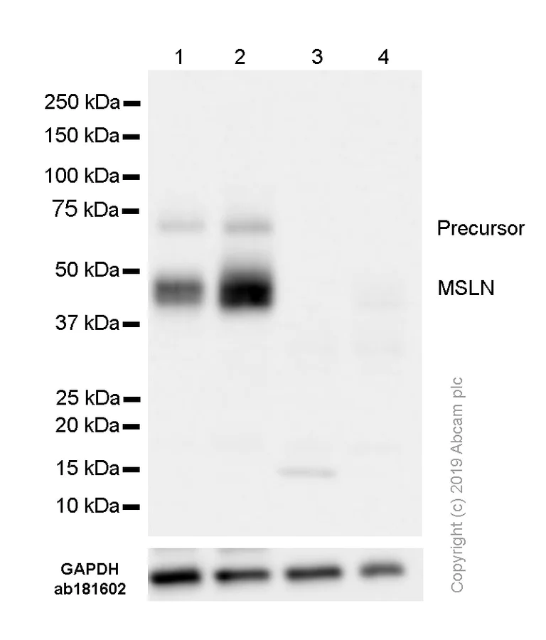 Anti-Mesothelin antibody [SP74] Rabbit monoclonal (ab93620) | Abcam
