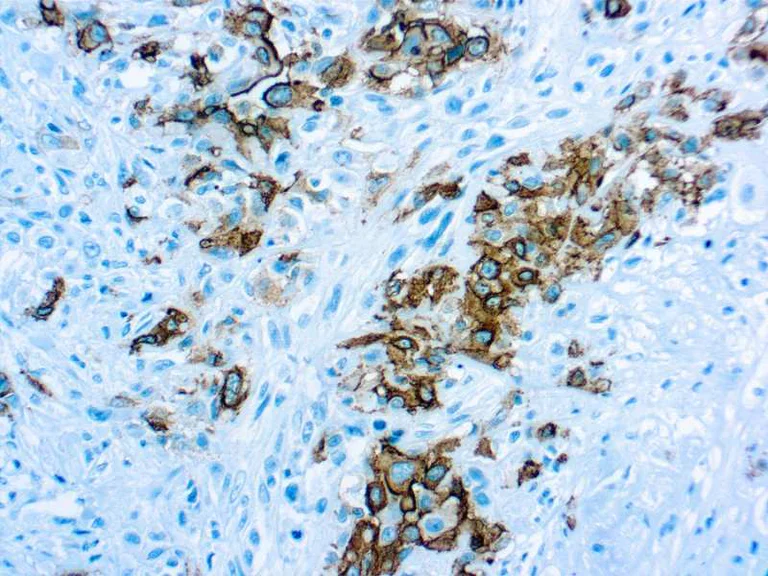 Anti-Mesothelioma antibody [HBME-1] (ab2383) | Abcam