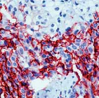 Anti-Mesothelioma antibody [HBME-1] (ab2383) | Abcam
