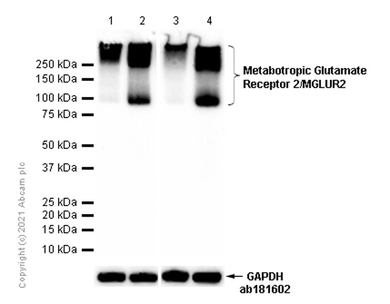 Anti-Metabotropic Glutamate Receptor 2 + 3 / MGLUR2 + MGLUR3 antibody ...