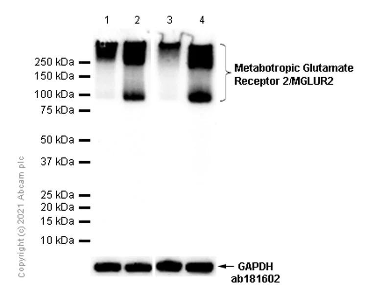 Anti-Metabotropic Glutamate Receptor 2 + 3 / MGLUR2 + MGLUR3 antibody ...