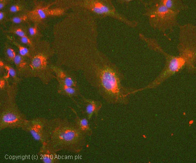 Anti-Metabotropic Glutamate Receptor 4/MGLUR4 抗体 (ab53088) | Abcam