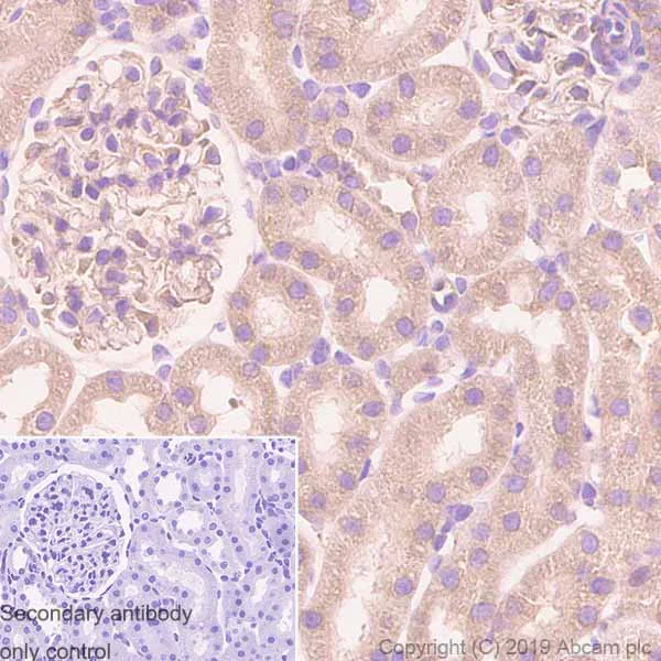 Anti-MetRS/MARS antibody [EPR9872] - BSA and Azide free (ab250200) | Abcam
