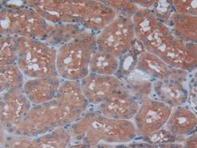 Anti-MGAM antibody (ab231229) | Abcam