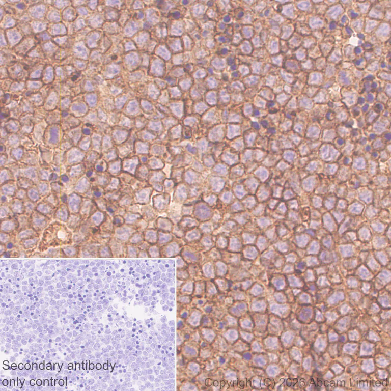 Anti-MHC Class I H2-Kb antibody [MJF-D30006-601] (ab327061) | Abcam中文官网