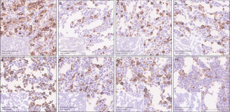 Anti-MHC Class I H2-Kb antibody [MJF-D30006-601] - BSA and Azide free ...