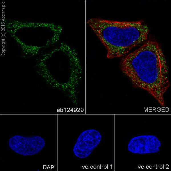 Anti-Mib1/Mindbomb antibody [EPR2762(2)] (ab124929) | Abcam
