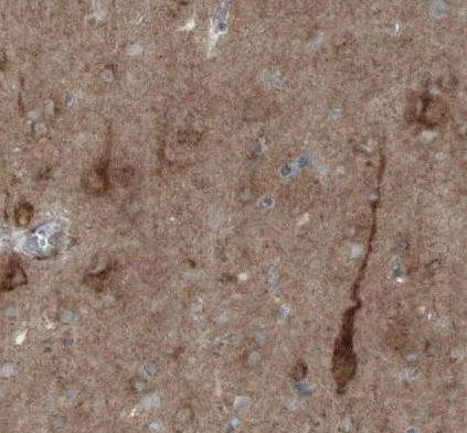 Anti-MIRO1 antibody [CL1095] (ab223750) | Abcam