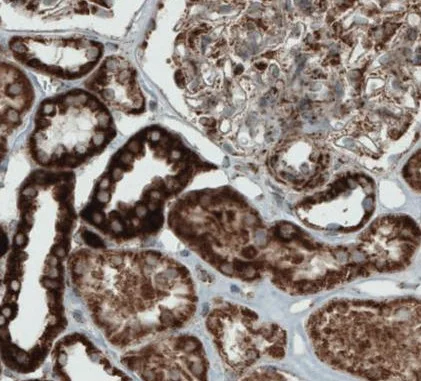 Anti-MIRO1 antibody [CL1095] (ab223750) | Abcam