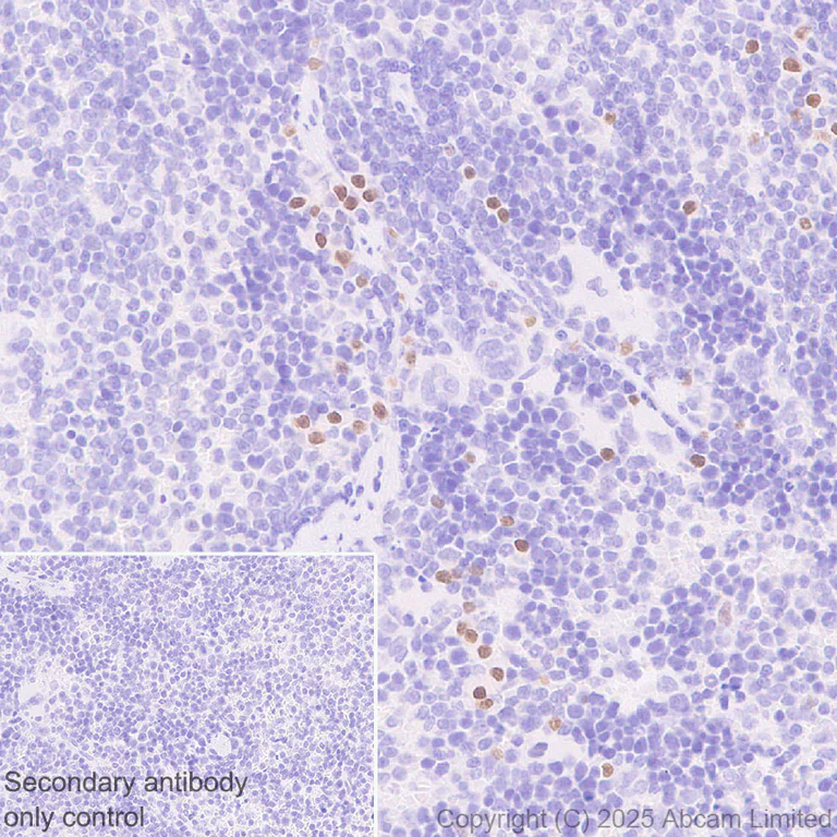Anti-MIST-1 antibody [EPR29652-63] (ab324434) | Abcam