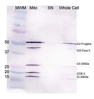 Mitochondria isolation kit for cultured cells, 60-min assay (ab110170 ...
