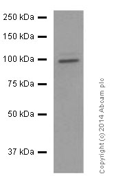 Anti-MKLP1 antibody [EPR10879] Rabbit monoclonal (ab174304) | Abcam