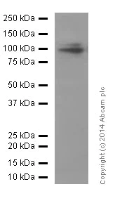 MKLP1抗体[EPR10879] (ab174304)| Abcam中文官网