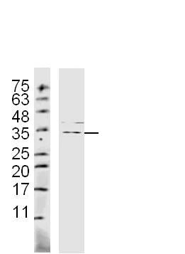 MMP7抗体 (ab216631)| Abcam中文官网