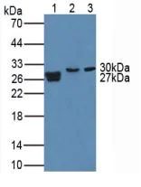 Anti-MMP7 antibody (ab232737) | Abcam