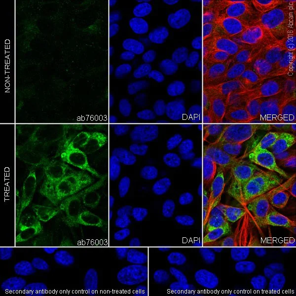 Anti-MMP9 antibody [EP1254] - recombinant (ab76003) | Abcam