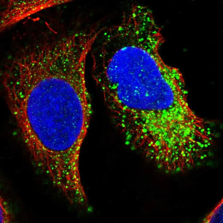 Anti-MMRN2 antibody (ab121639) | Abcam