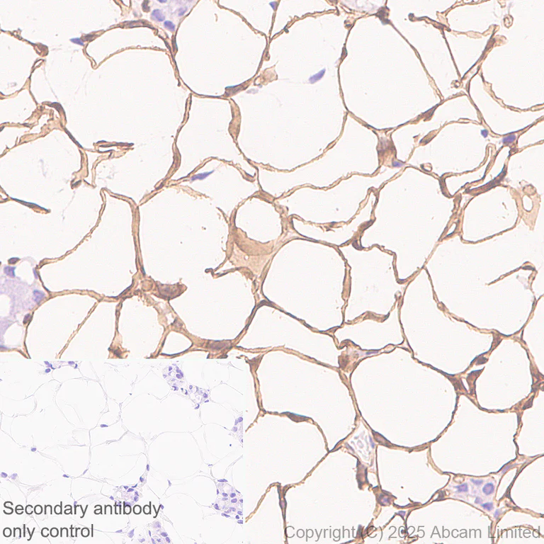 Anti-Monoacylglycerol Lipase/MGL antibody [RM1358] (ab325000) | Abcam中文官网