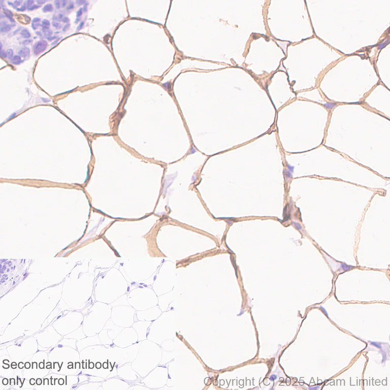Anti-Monoacylglycerol Lipase/MGL antibody [RM1358] (ab325000) | Abcam中文官网
