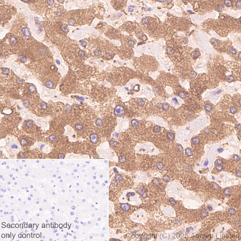 Anti-Monoacylglycerol Lipase/MGL antibody [RM1358] (ab325000) | Abcam中文官网