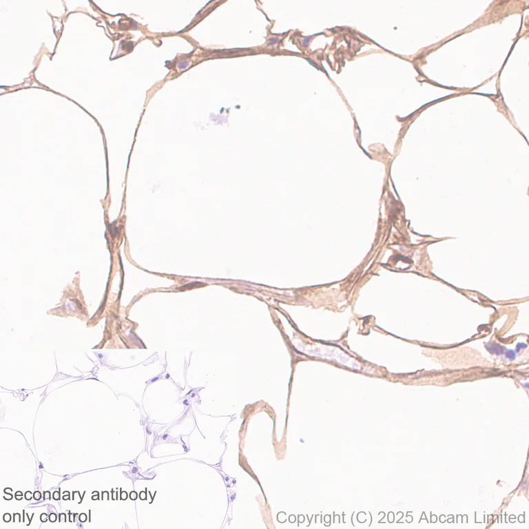 Anti-Monoacylglycerol Lipase/MGL antibody [RM1358] (ab325000) | Abcam中文官网