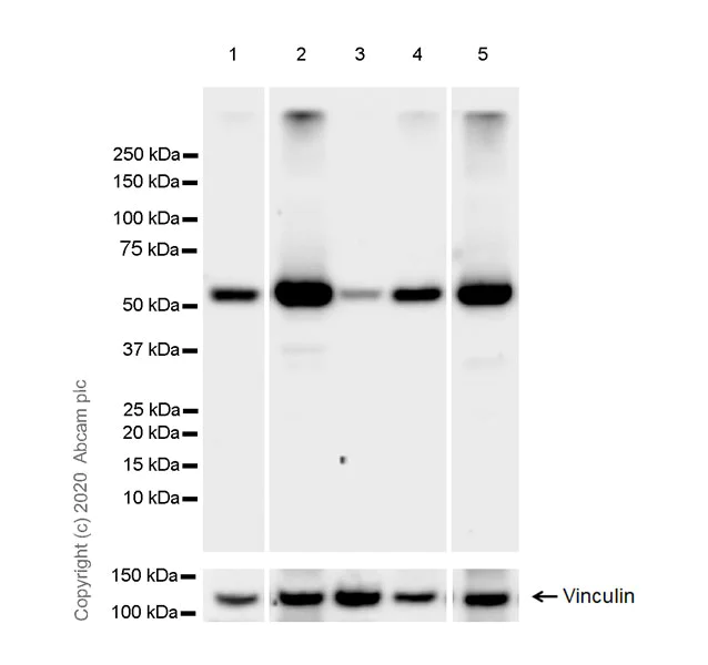 Anti-Monoamine Oxidase B/MAOB antibody [EPR24131-79] - BSA and Azide ...