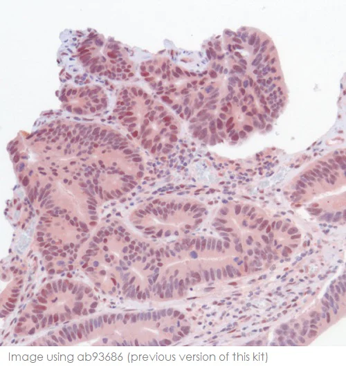 Mouse and Rabbit Specific HRP/AEC IHC Detection Kit - Micro-polymer ...