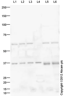 Mouse eye tissue lysate - total protein (ab4029) | Abcam