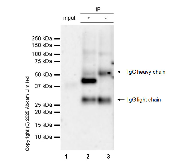 小鼠IgG1, kappa单克隆抗体[MOPC-21] - isotype control (ab18443)| Abcam中文官网