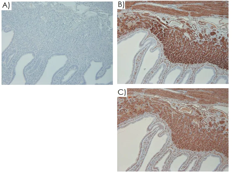 Mouse on mouse IHC kit (polymer) - 15, 60 mL (ab269452) | Abcam