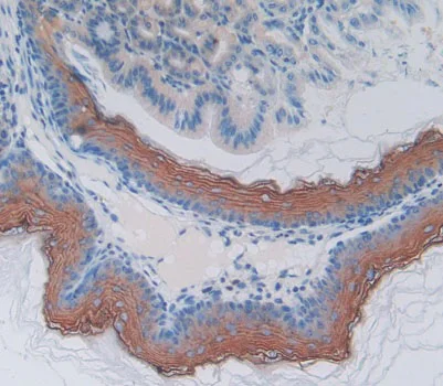 Anti-MPP2/DLG2 antibody (ab231634) | Abcam