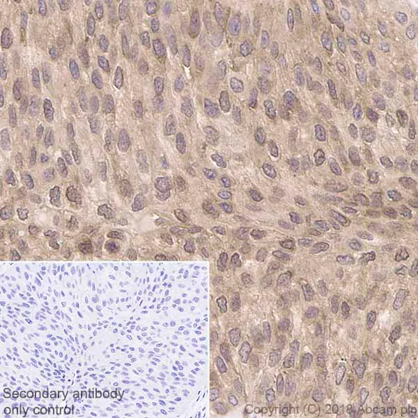 Anti-MSI2 antibody [EP1305Y] (ab76148) | Abcam
