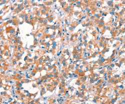 Anti-MT-CYB antibody (ab198860) | Abcam
