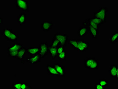Anti-MT1E antibody (ab193618) | Abcam