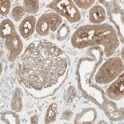 Anti-MTM1 antibody (ab223719) | Abcam